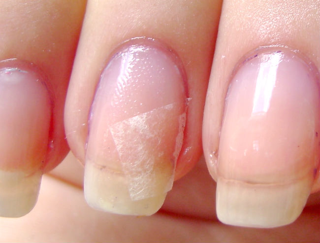Aprende a reparar las uñas quebradas en 3 pasos - Unicas